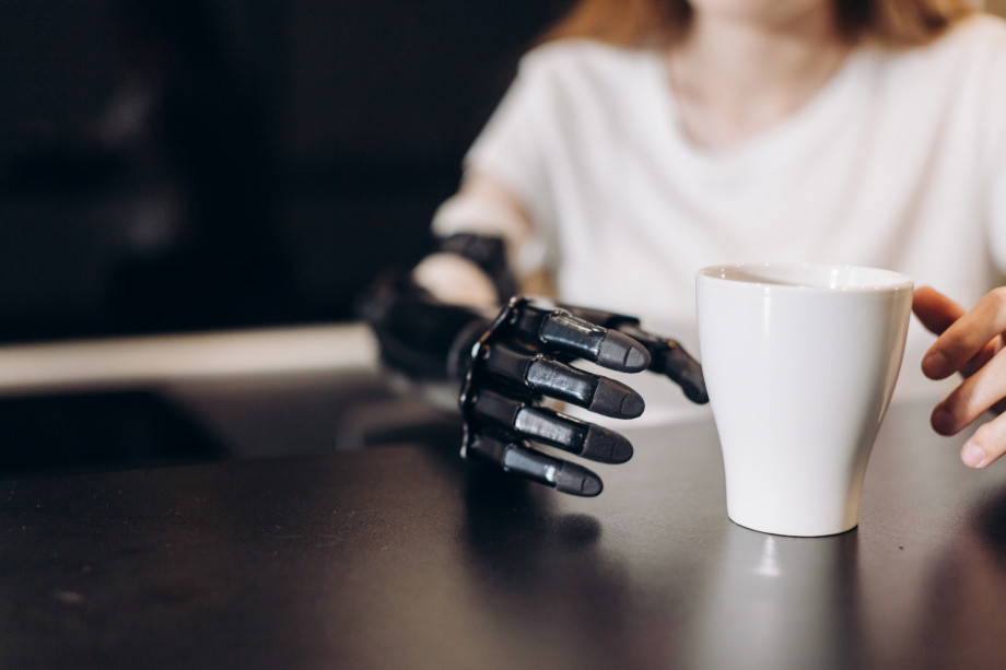 Most Advanced Prosthetic Arm 2022